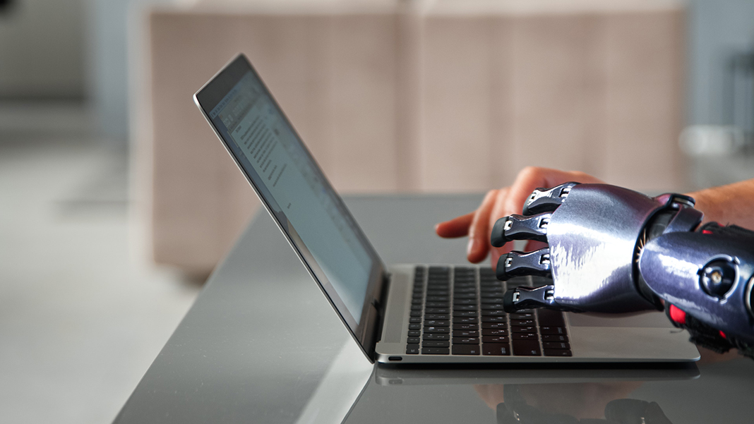 Revolutionizing Touch Screen Use for Prosthetic Hands - Industry Today ...